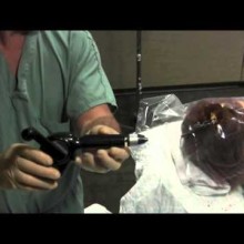 Bedside EVD insertion : 네이버 블로그