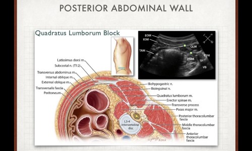 TAP block ultrasound guided transversus abdominis plane (TAP) block ...