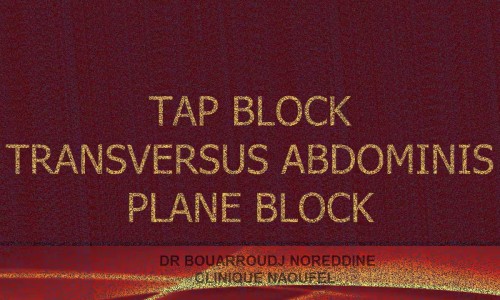 TAP block ultrasound guided transversus abdominis plane (TAP) block ...