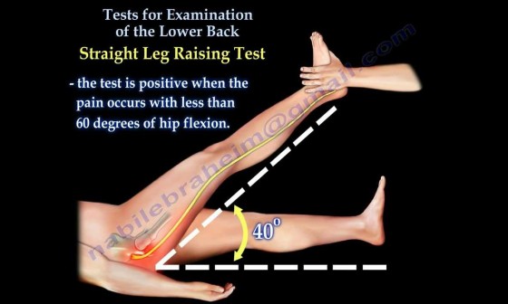 여러가지 요추검진 - SLR test, CSLR test, 패트릭검사, Waddell's sign 등 : 네이버 블로그