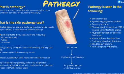 베체트병(Behcet disease) : 네이버 블로그